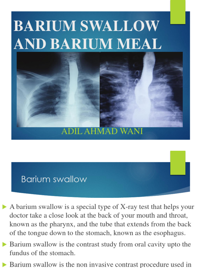 Barium Swallow & Barium Meal Shubhashish Mondal | PDF | Esophagus | Stomach