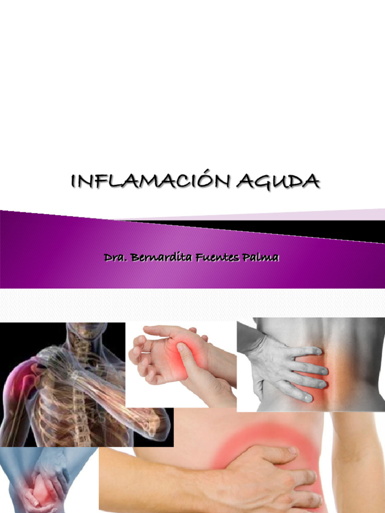Características de la Inflamación Aguda | PDF | Inflamación | Inmunología