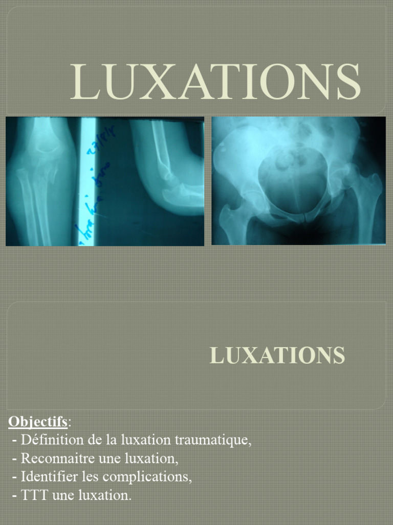 Luxation S | PDF | Blessure | Maladies et troubles humains
