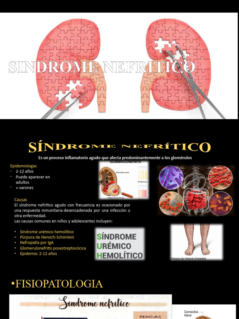 Sindrome Nefritico | PDF | Condiciones urológicas | Especialidades Medicas