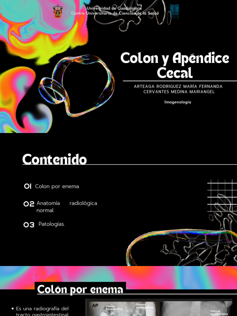 Colon y Apéndice Cecal | PDF | Intestino grueso | Cáncer colonrectal