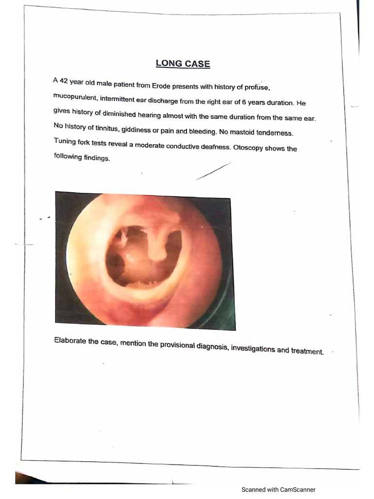 ENT - Long Case | PDF