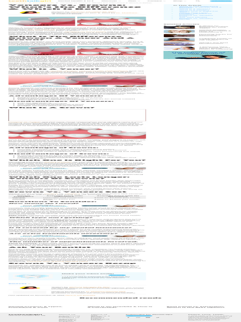 Veneers vs. Crowns: Key Differences Explained | PDF | Dentistry | Tooth
