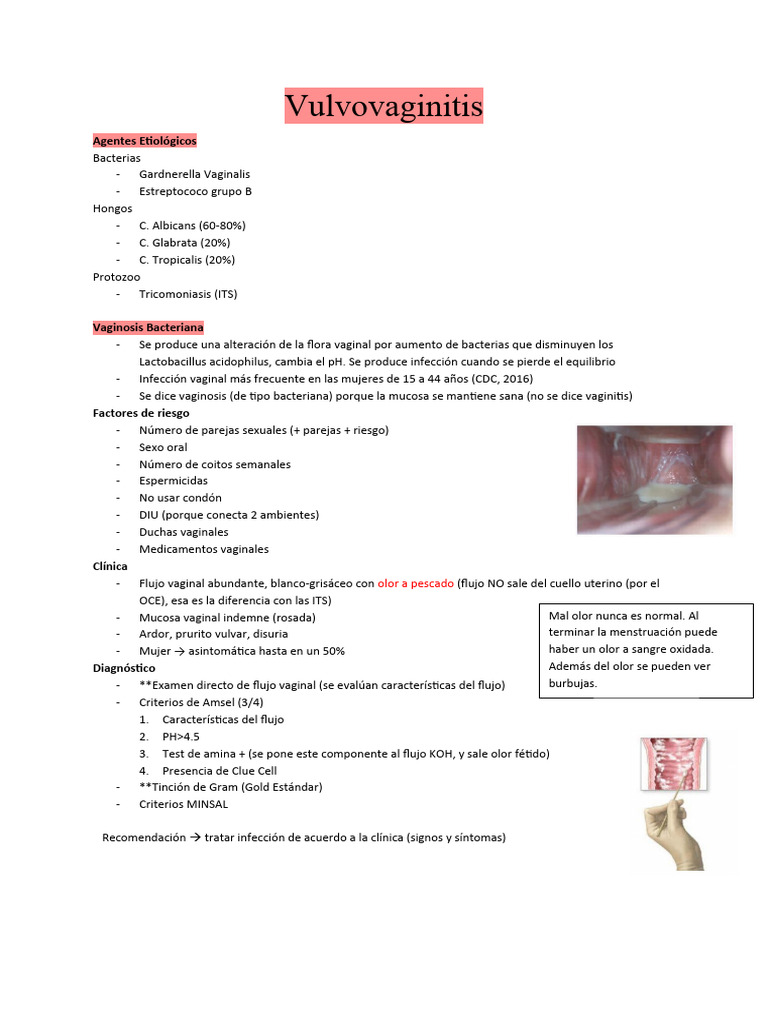 Vulvovaginitis | PDF | Especialidades Medicas | Medicina CLINICA