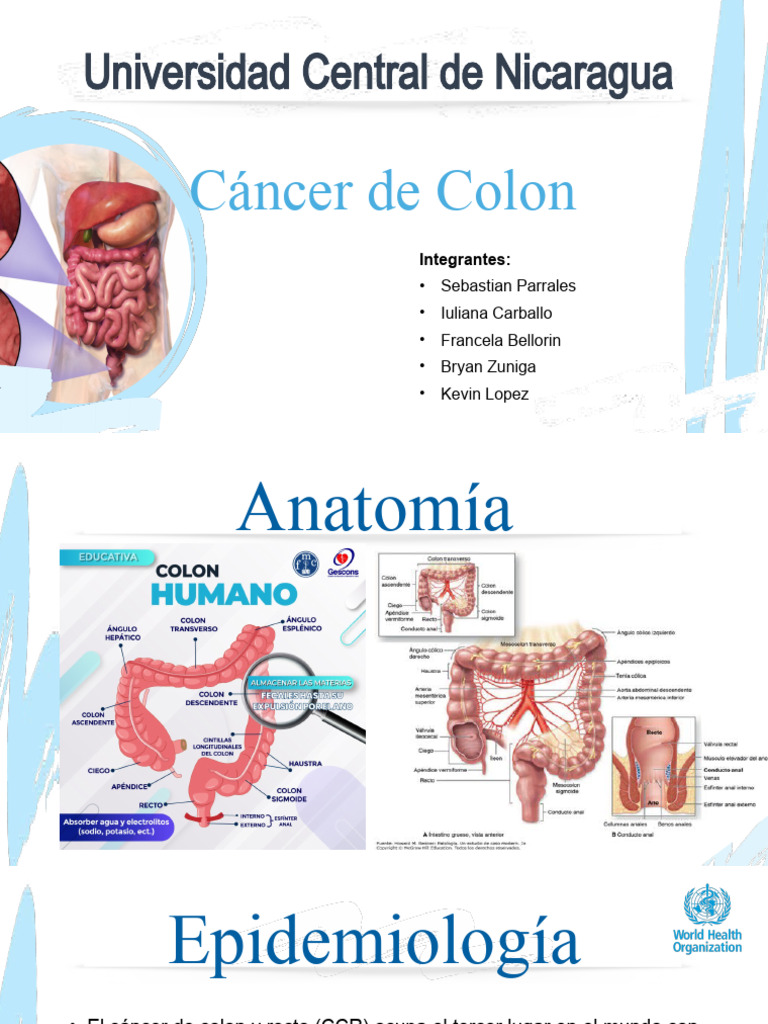 Exposicion Ca. Colon | PDF | Cáncer | Cáncer colonrectal