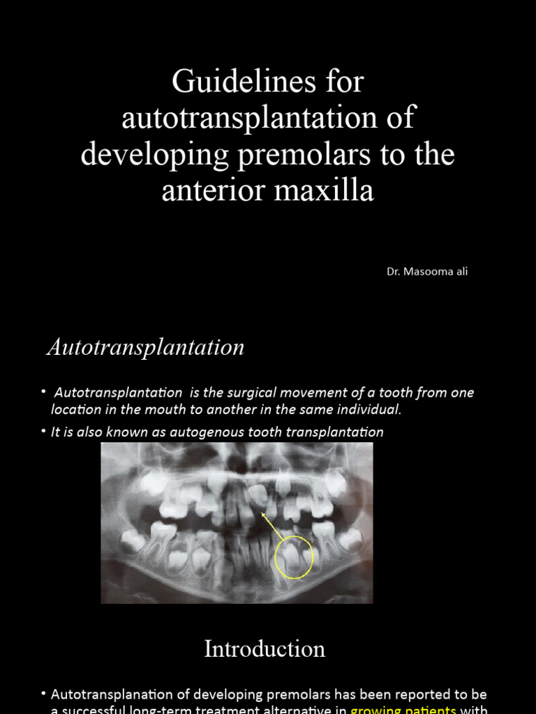 Premolar Autotransplantation Guide | PDF
