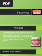 Materiales y Tecnicas de Encerado | PDF | Ramas de Odontología