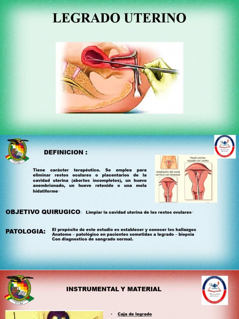 Legrado Uterino | PDF