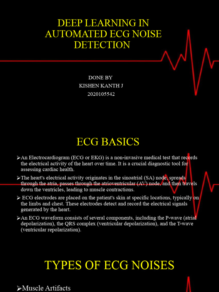Deep Learning for ECG Noise Detection | PDF | Electrocardiography | Deep Learning