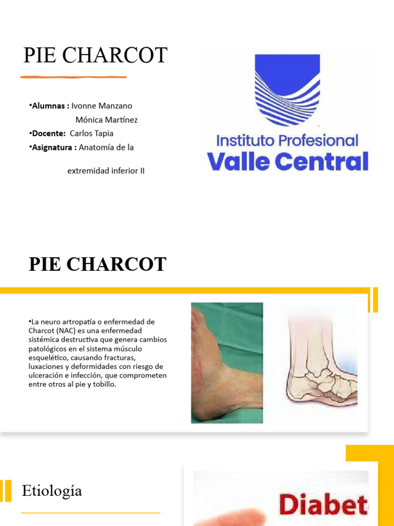 Pie Charcot | PDF