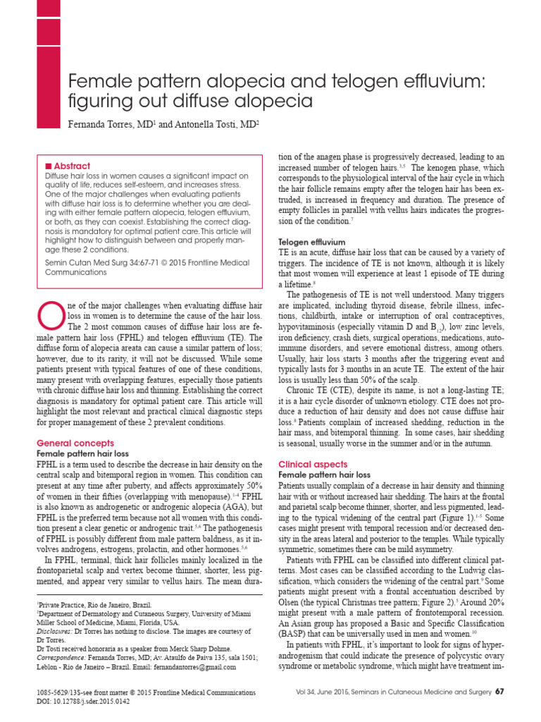 15 Female Pattern Alopecia and Telogen Effluvium, Figuring Out Diffuse ...