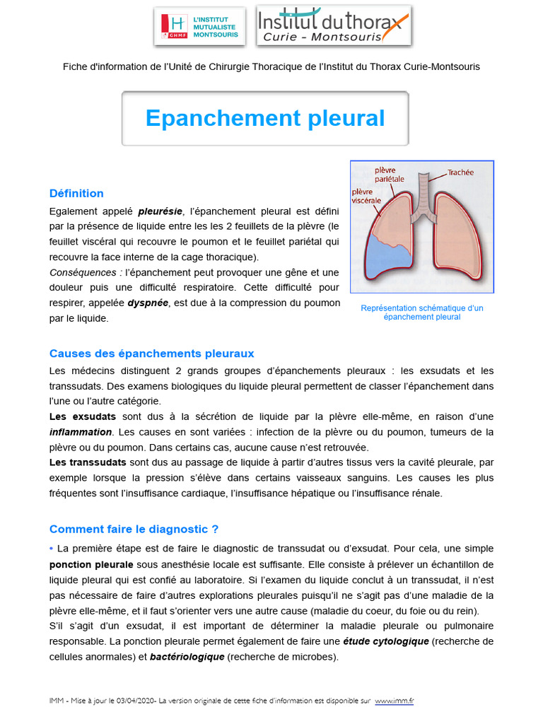 Fiche Epanchement Pleural | PDF