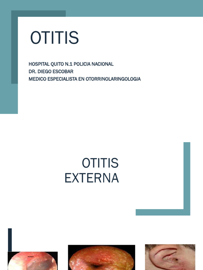 OTITIS | PDF