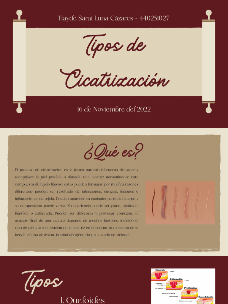 Tipos de Cicatrización | PDF | Cicatriz | Cicatrización de la herida