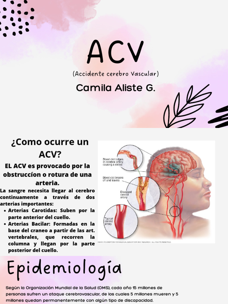ACV (Accidente Cerebro Vascular) | PDF