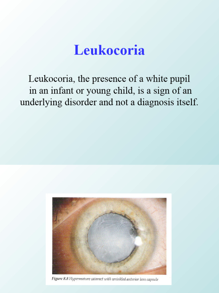 Leukocoria of Dermatology Sana'a University | PDF | Medicine | Human ...