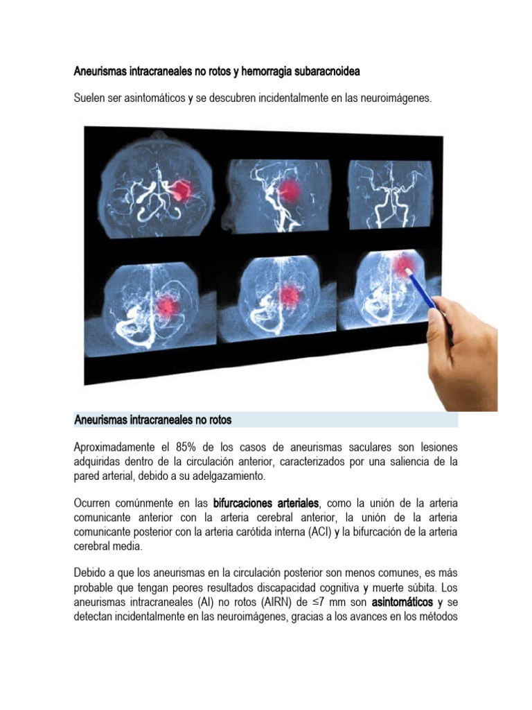 Aneurismas Intracraneales No Rotos y Hemorragia Subaracnoidea | PDF ...