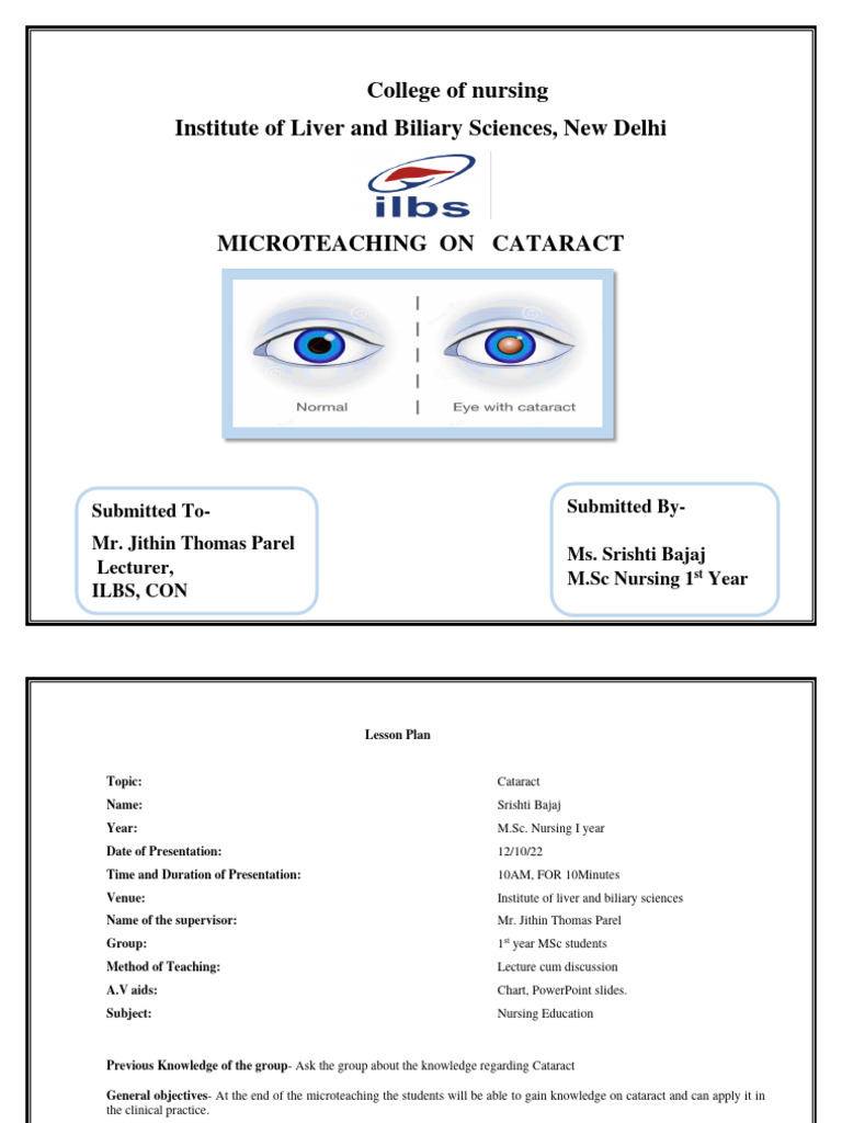 Cataract Final Lesson Plan | PDF