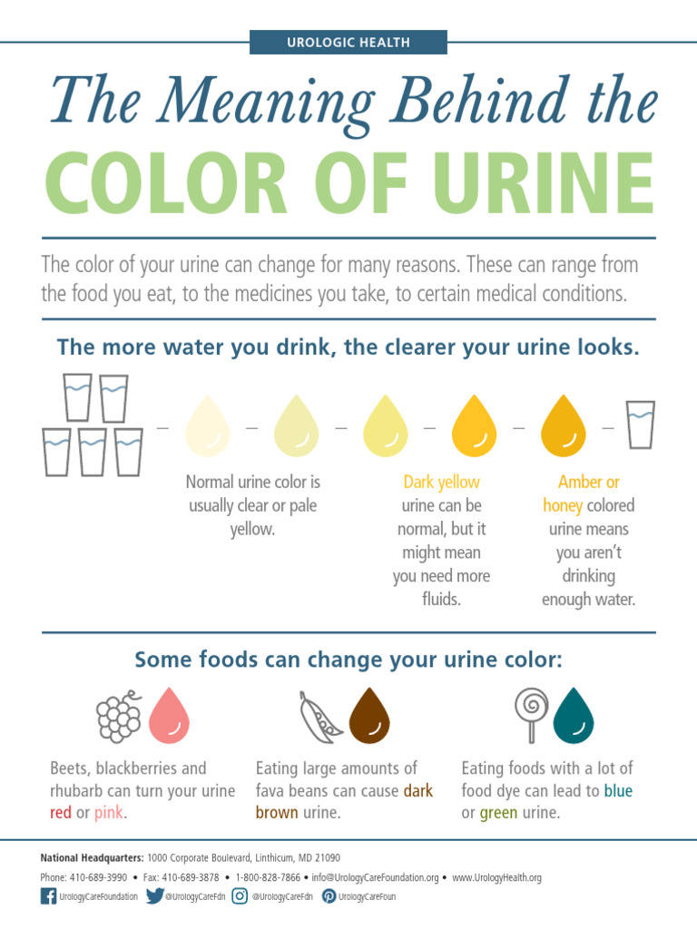 Color of Urine Infographic | PDF | Urine | Urinary System