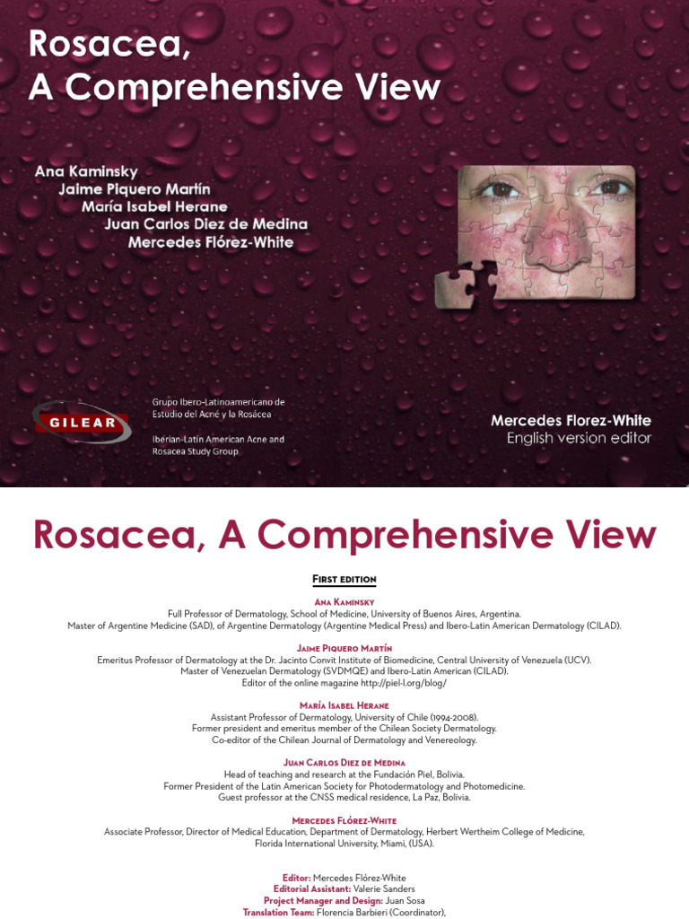 Rosacea, A Comprehensive View (Tablets) 2 | PDF