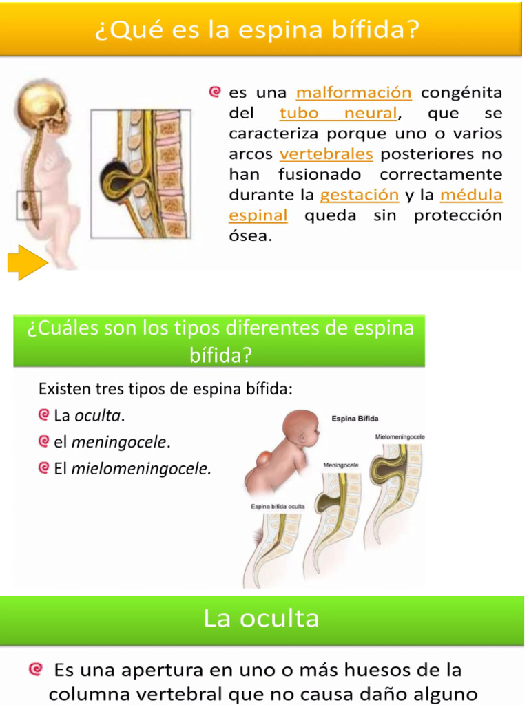 Presentación1 Espina Bifida | PDF