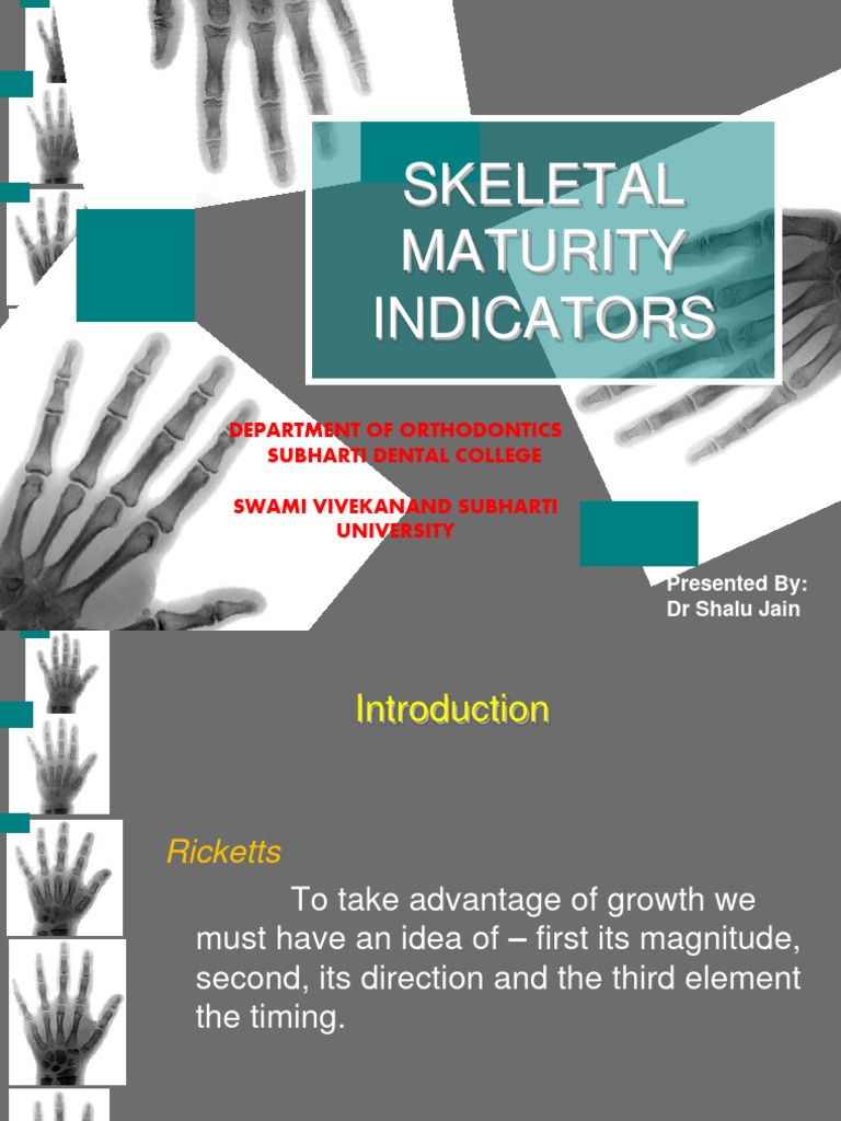 Skeletal Maturity Indicators: Department of Orthodontics Subharti ...