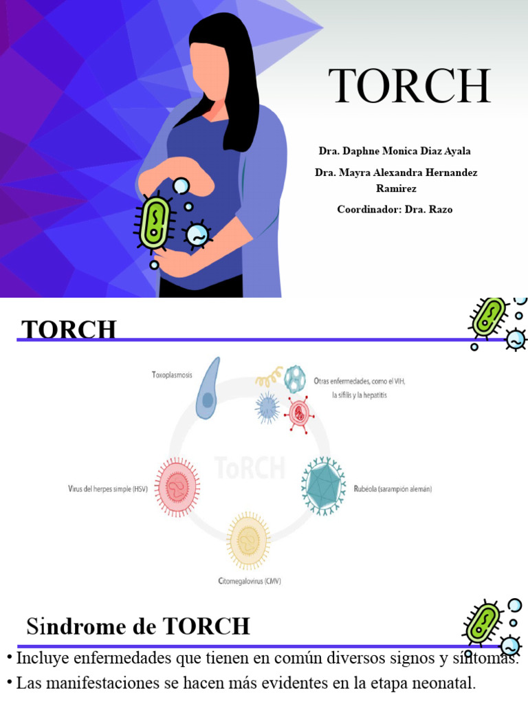 Torch | PDF