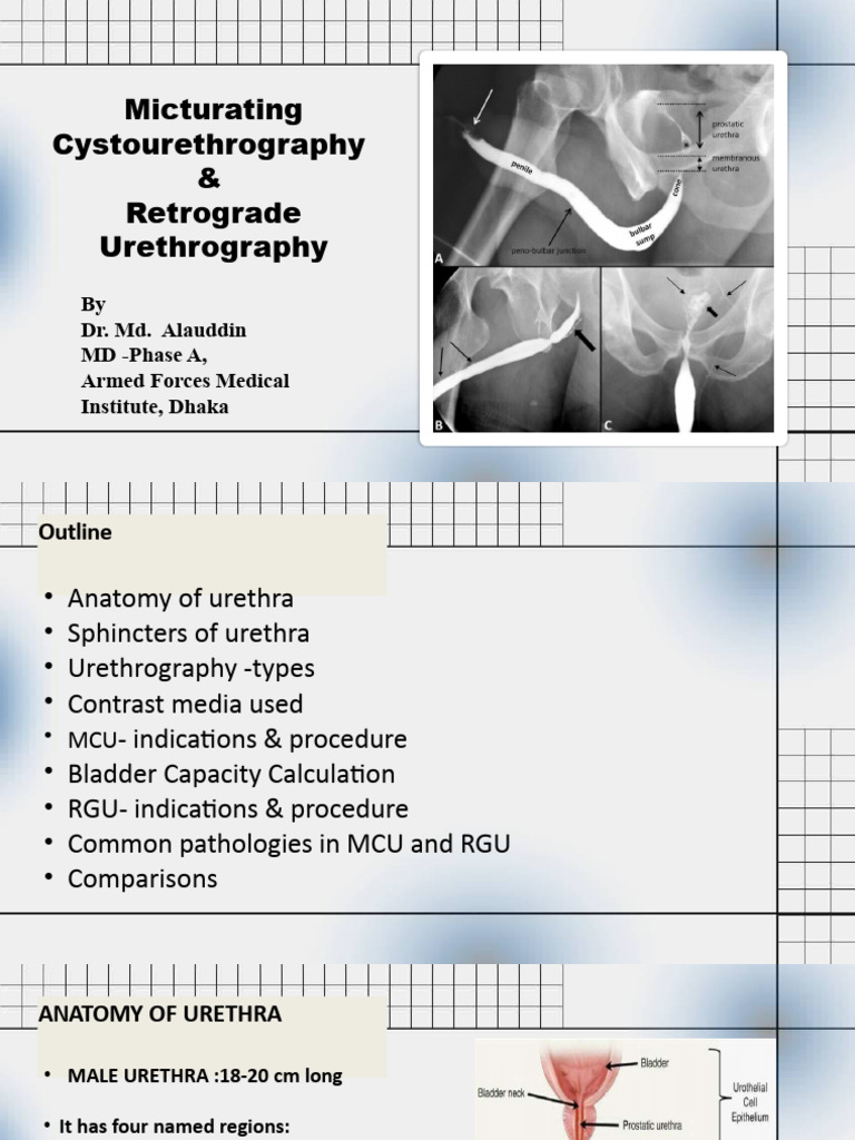 RGU and MCU PPT Final For 18.9.23, Bsmmu | PDF | Urinary System | Urology