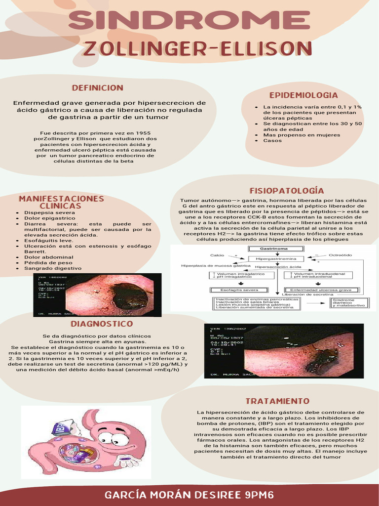 Síndrome de Zollinger Ellison | PDF | Estómago | Órgano (anatomía)