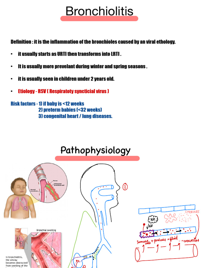 Bronchiolitis | PDF | Pulmonology | Clinical Medicine