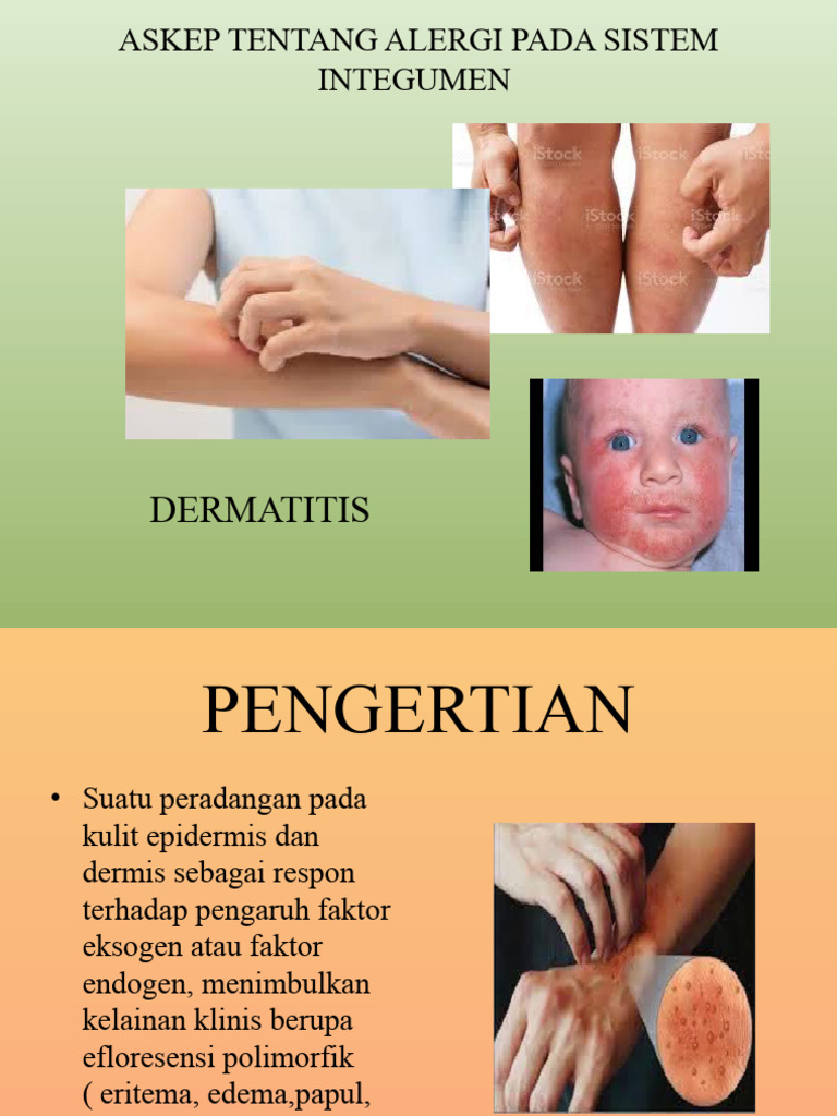 Dermatitis | PDF
