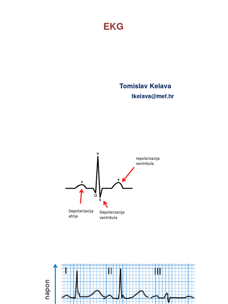 Ekg Prezentacija | PDF