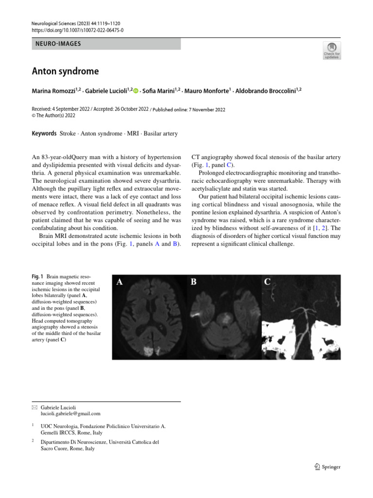 SD Anton | PDF | Nervous System | Neurological Disorders
