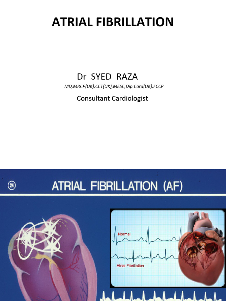 Atrial Fibrillation | PDF | Heart | Epidemiology