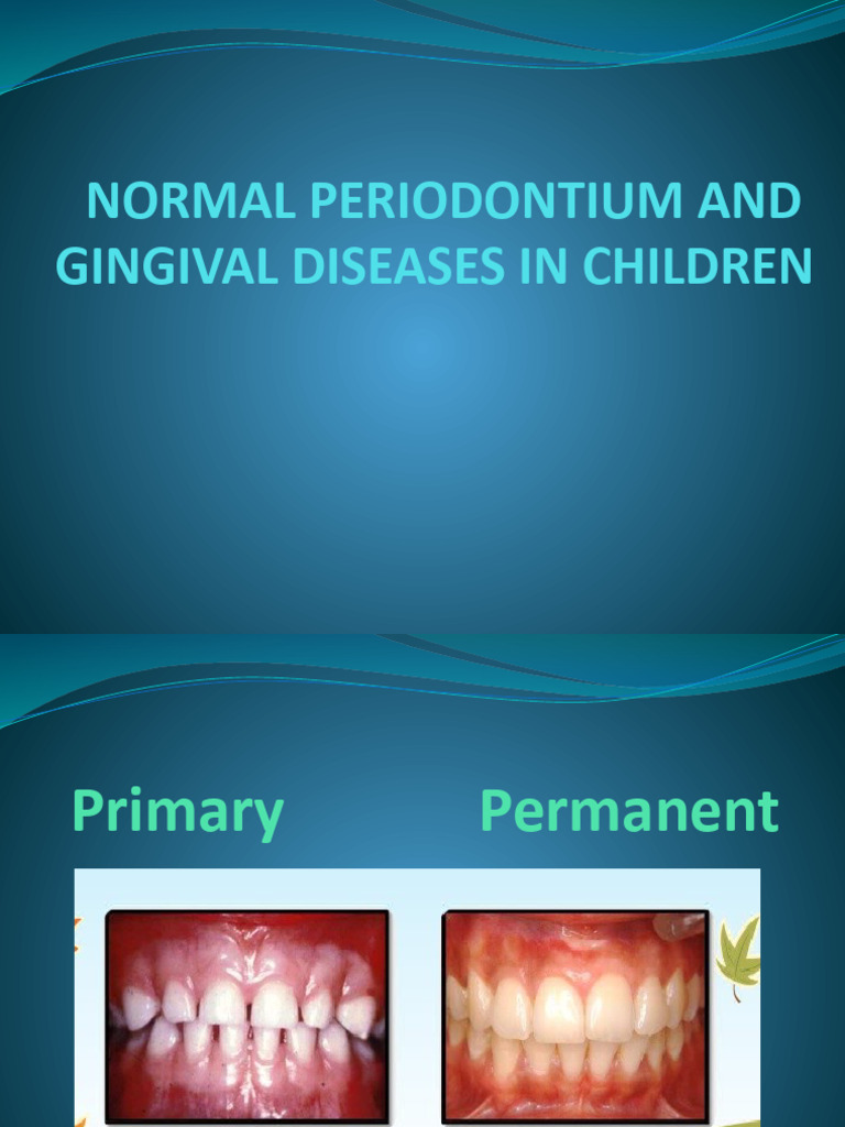 GINGIVAL AND PERIODONTAL DISEASES IN CHILDREN | PDF