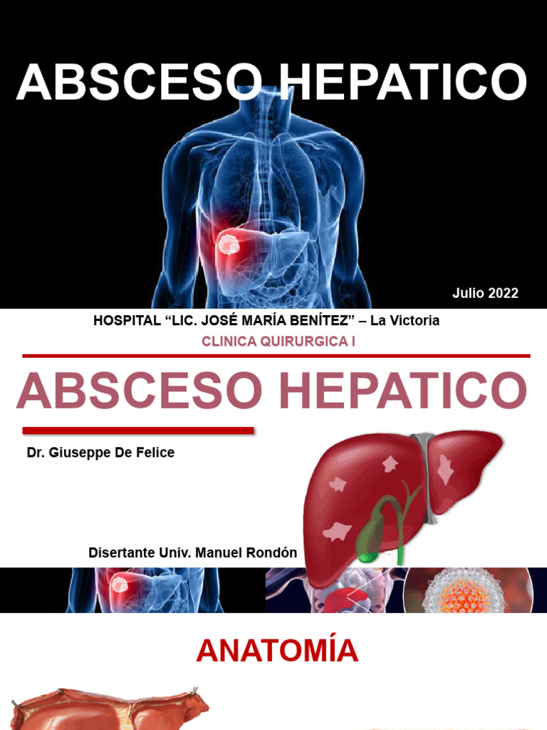 Manejo del Absceso Hepático | PDF | Hígado | Inmunología
