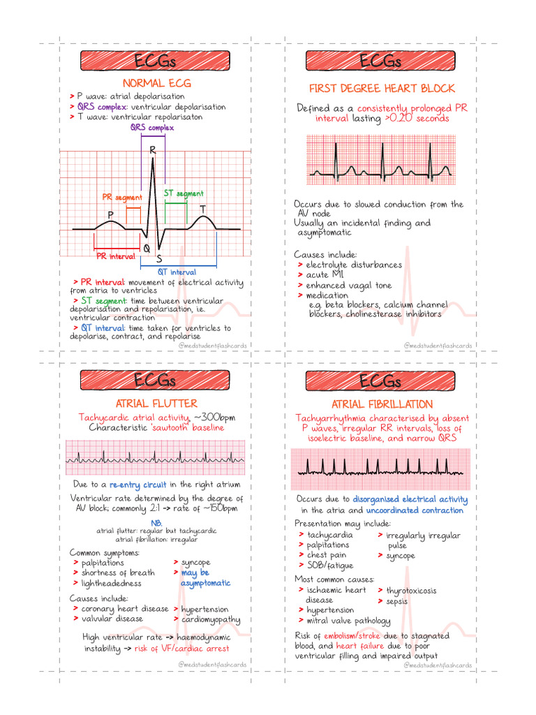 Fullcardstoprint Ecg | PDF | Electrocardiography | Heart
