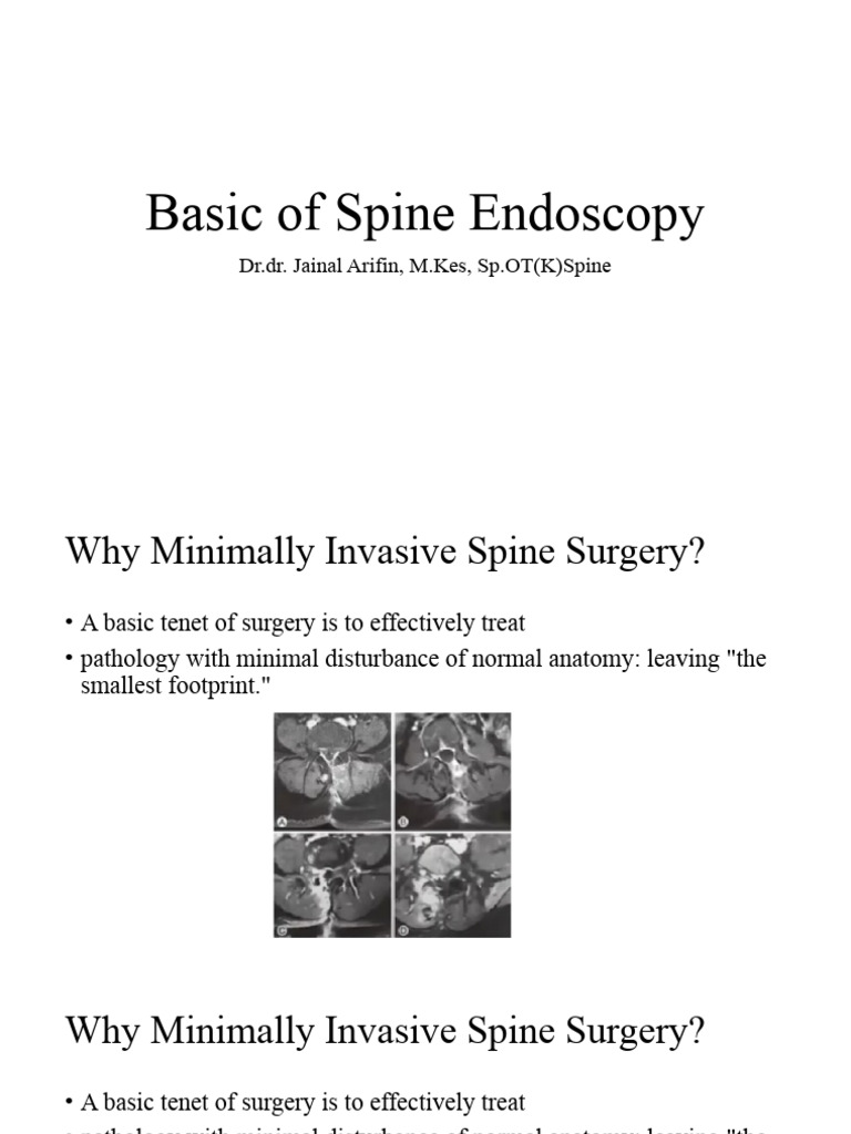 Basic of Spine Endoscopy (Fixed) | PDF