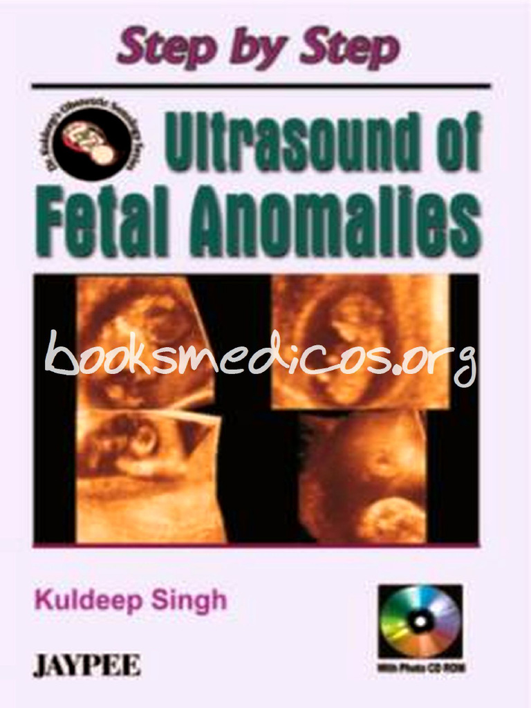 Step by Step Ultrasound of Fetal Anomalies | PDF