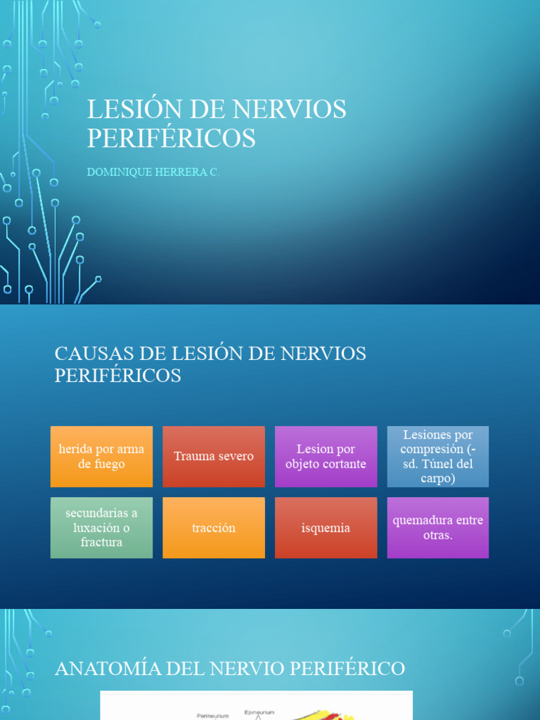 Lesión de nervios periféricos | PDF