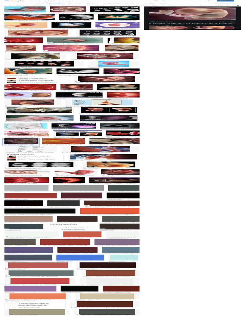 7 Week Human Embryo - Google Search | PDF | Pregnancy | Prenatal ...