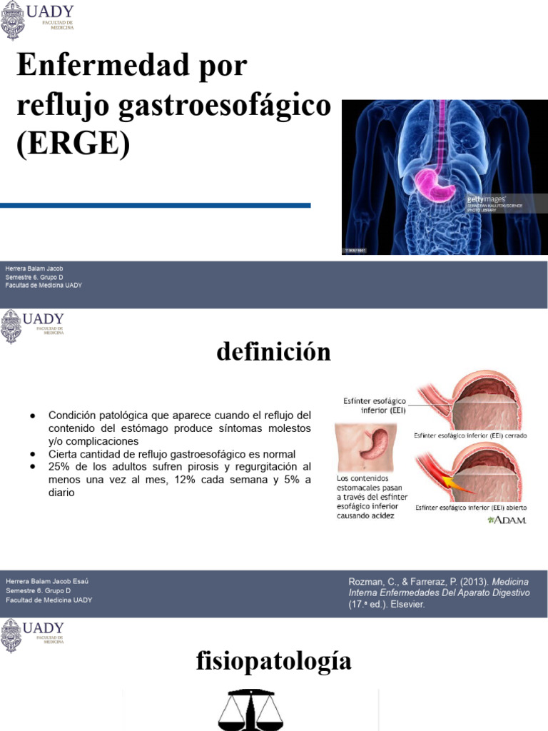 Enfermedad Por Reflujo Gastroesofágico (ERGE) | PDF | La enfermedad por reflujo gastroesofágico ...
