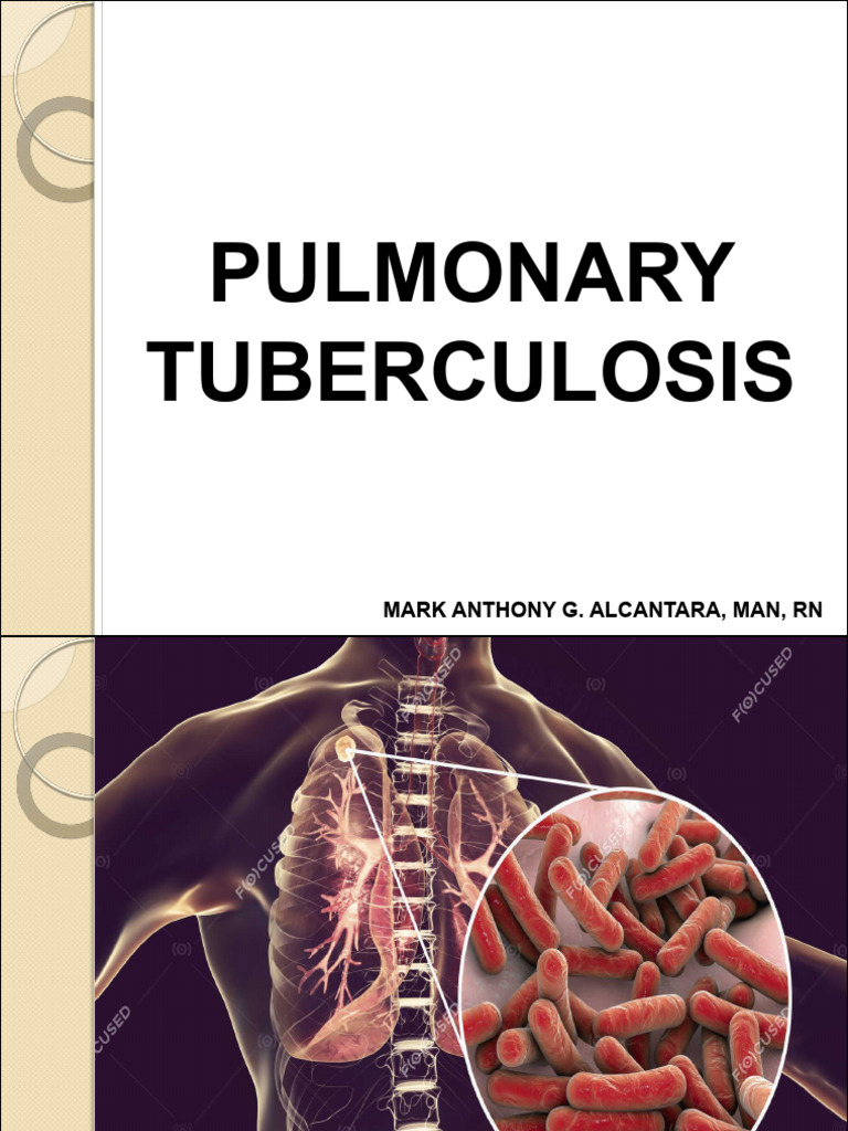 Pulmonary Tuberculosis | PDF | Tuberculosis | Clinical Medicine