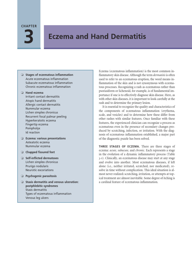 Eczema | PDF | Dermatitis | Topical Medication