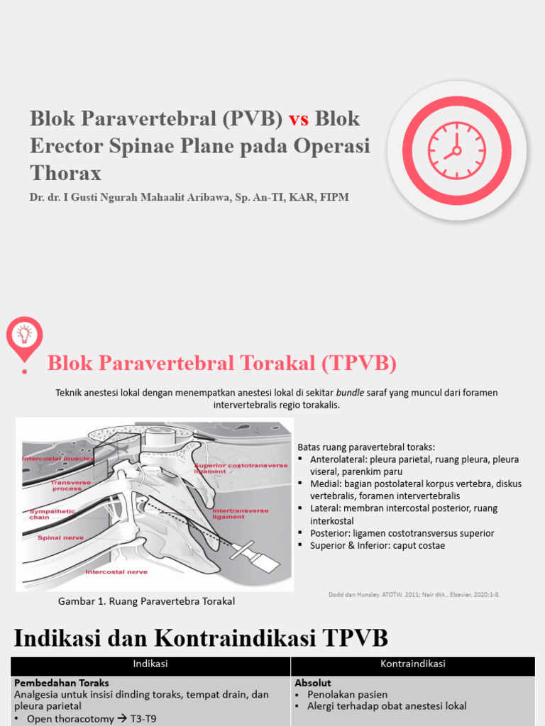 PVB Vs ESP | PDF
