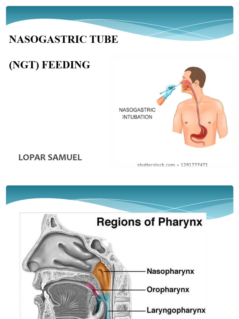 Ng Tube Insertion Pdf Esophagus Gastrointestinal Tract