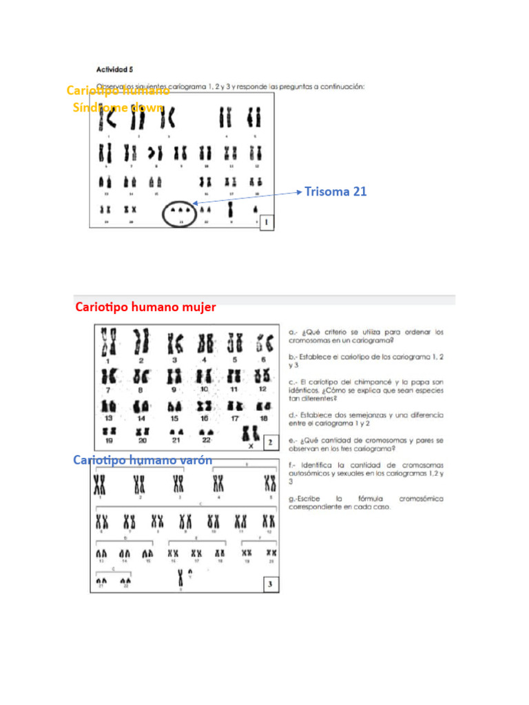 Actividad 5 Cariogramas | PDF | Síndrome de Down | Cromosoma