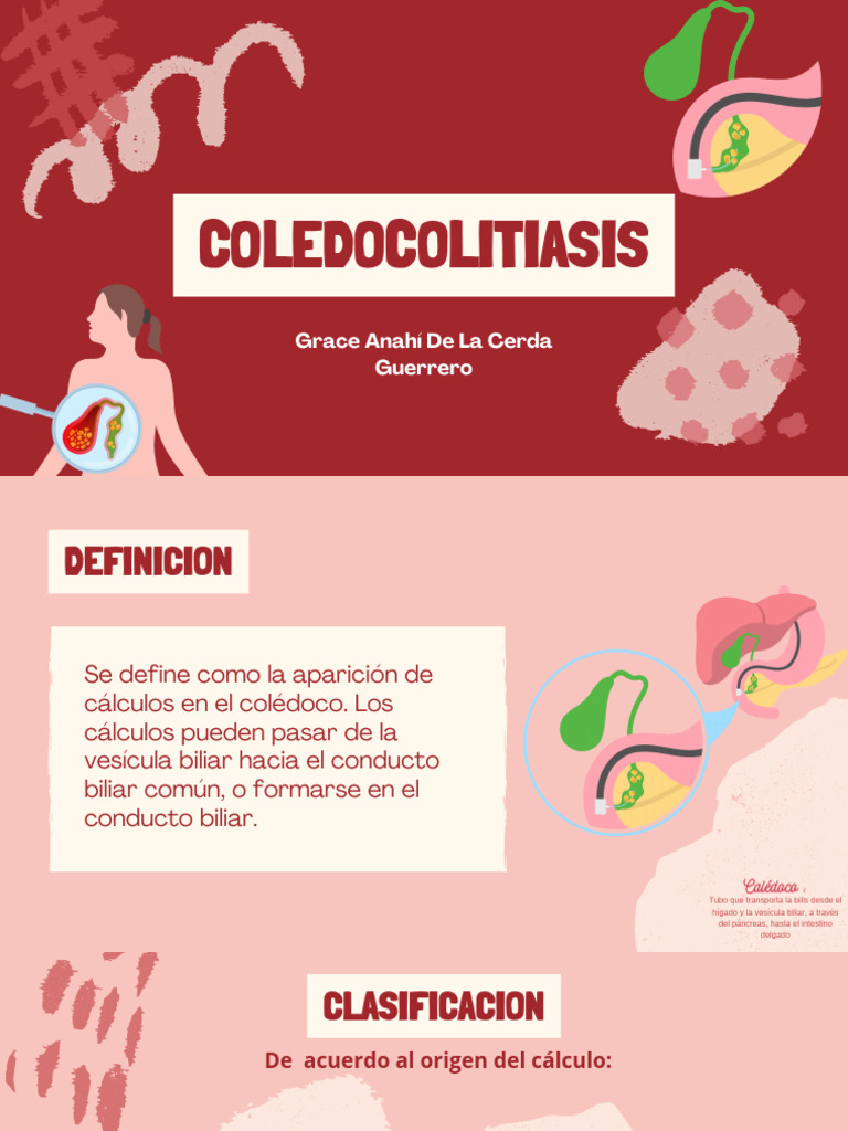 Coledocolitiasis | PDF | Bilis | Vesícula biliar