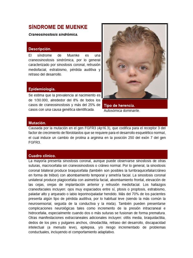 Sindrome de Muenke | PDF | Pediatría | Medicina