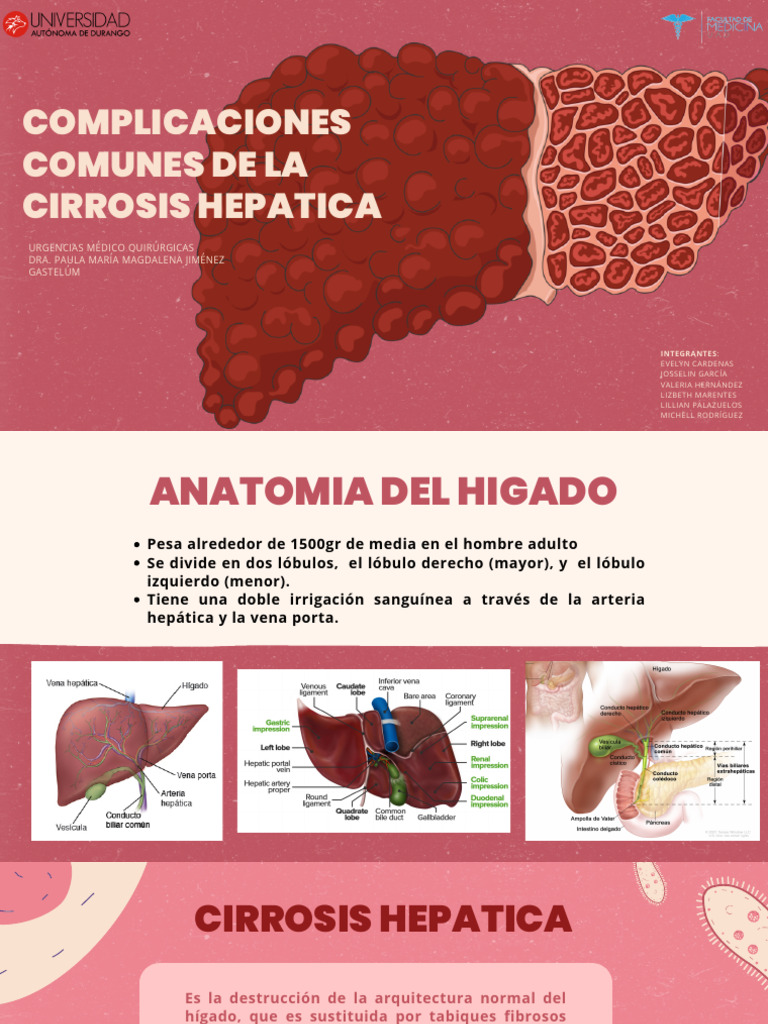 Complicaciones de La Cirrosis Hepática | PDF | Cirrosis | Enfermedades y trastornos